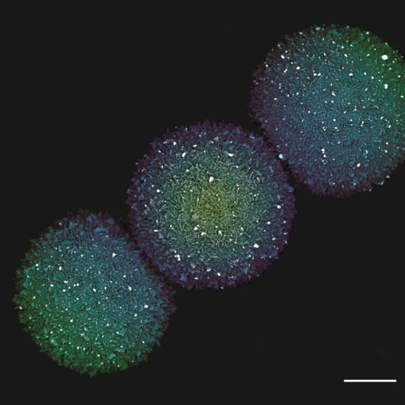 FE-SEM Thermo Fisher Teneo